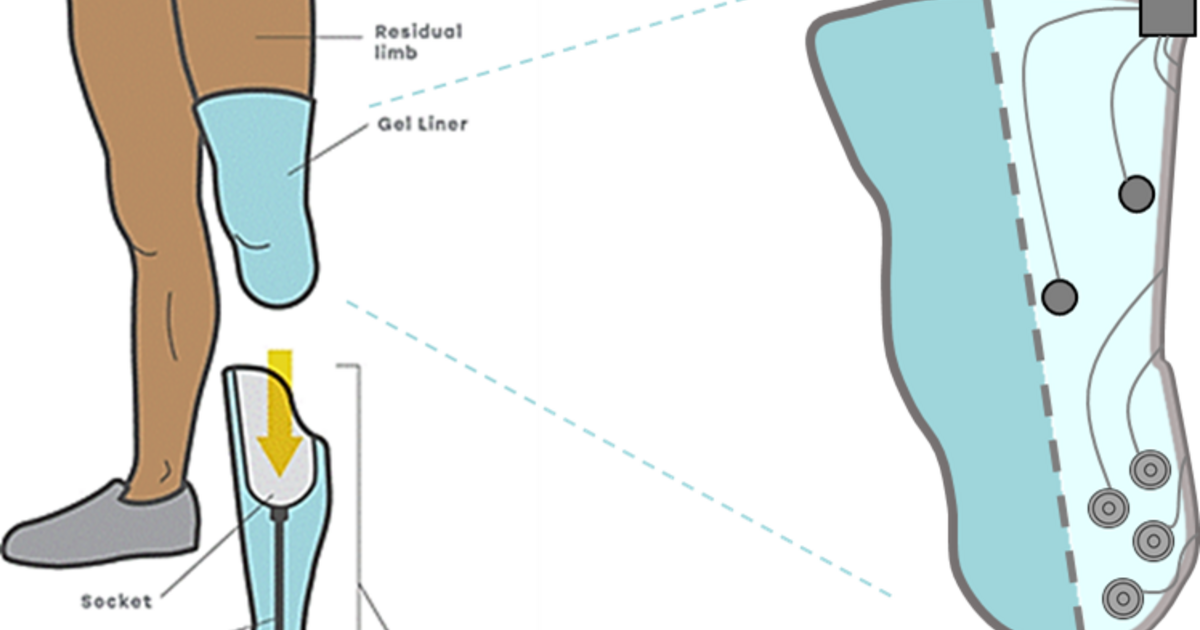 Prothesen-Linersystem mit spezifischer Mehrschichtsensormatrix - IÖB ...