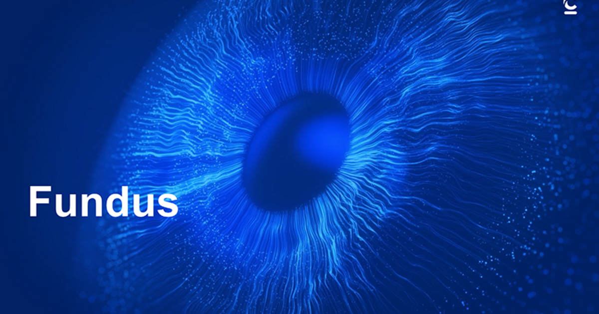 Fundus - IÖB Innovationsplattform